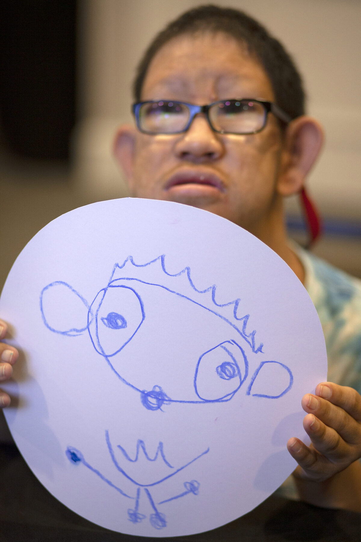 Anthony2MA - Lowe Syndrome Association